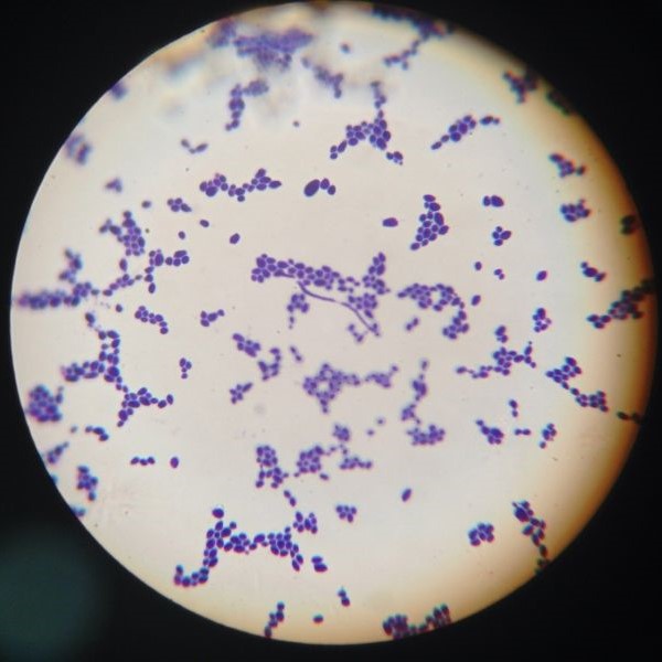 Is candida a yeast store