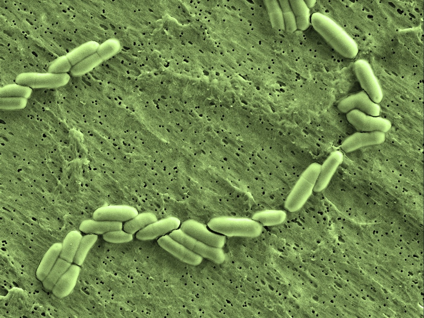 Huge Study on B. lactis BB-12 for Regularity | Professionals