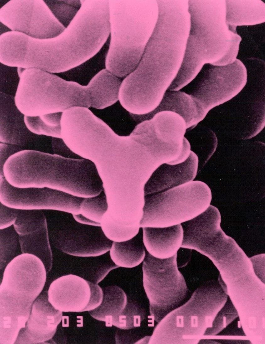 Bifidobacterium Strain Helps Reduce Colds | Professionals