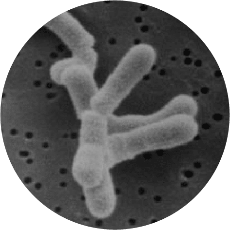 Bifidobacterium infantis 35624 | Database